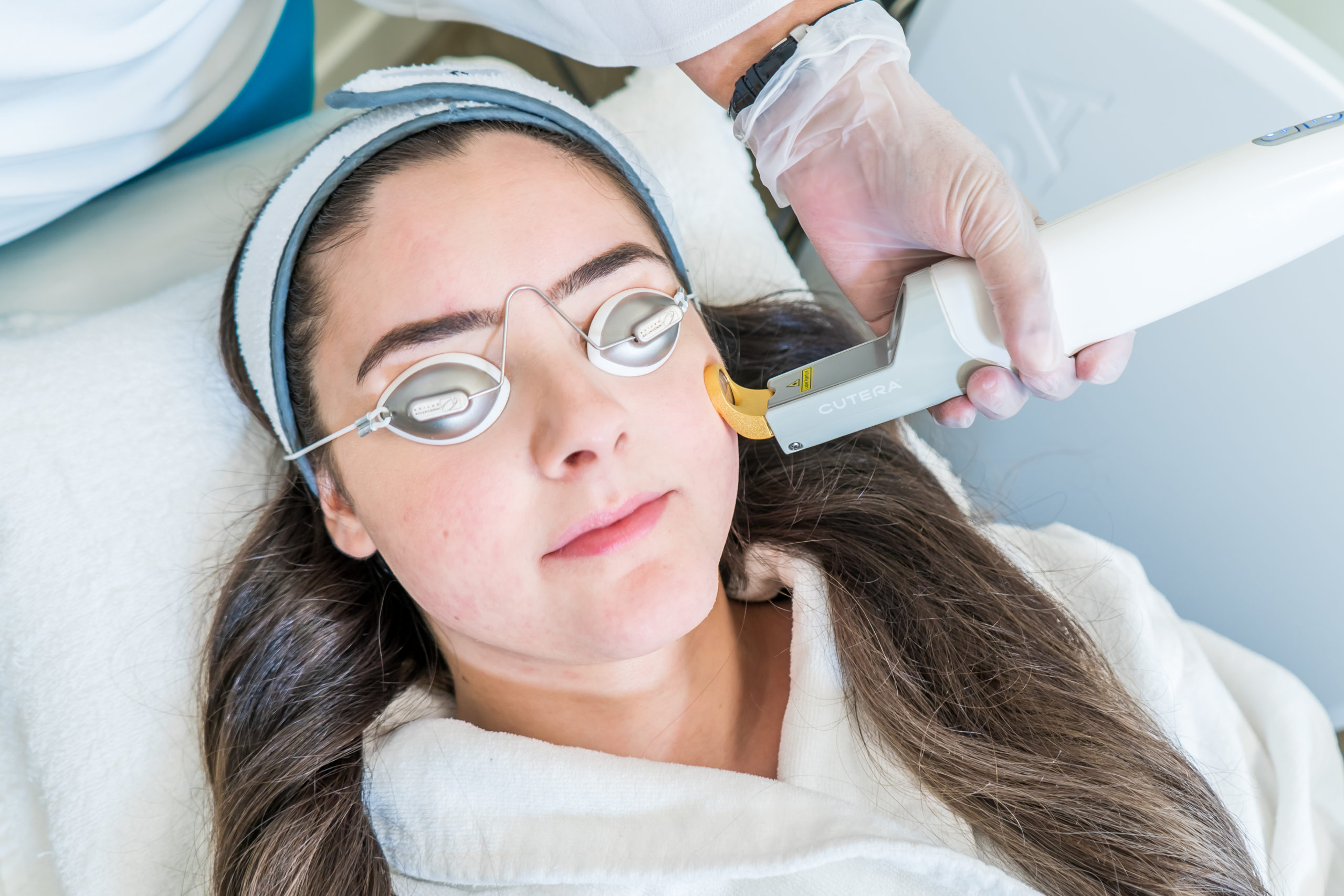 Cutera® excel® V Laser - Alaska Center for Dermatology